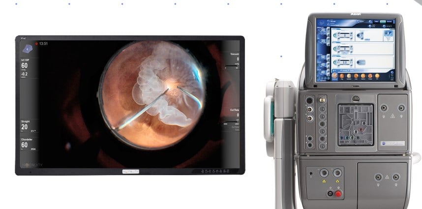 Vitreoretinal Surgery - Ophthalmological clinics "Excimer" (Odessa) - diagnostics and treatment ...